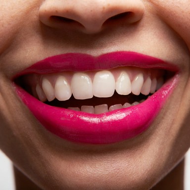 Nehl Dental - 10 Invisalign Truths to Know Before You Try - Nehl Dental