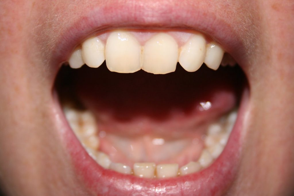 Nehl Dental - Beyond Teeth: What's Inside Your Mouth - Nehl Dental